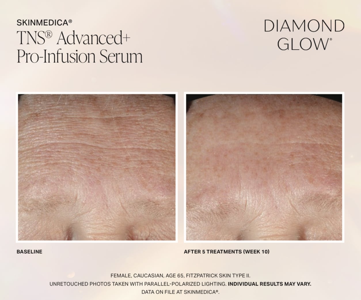 NEW* DiamondGlow Facial Treatment – BodiSculpting Specialists